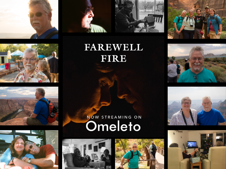 Adult-Onset Leukoencephalopathy With Axonal Spheroids and Pigmented ...