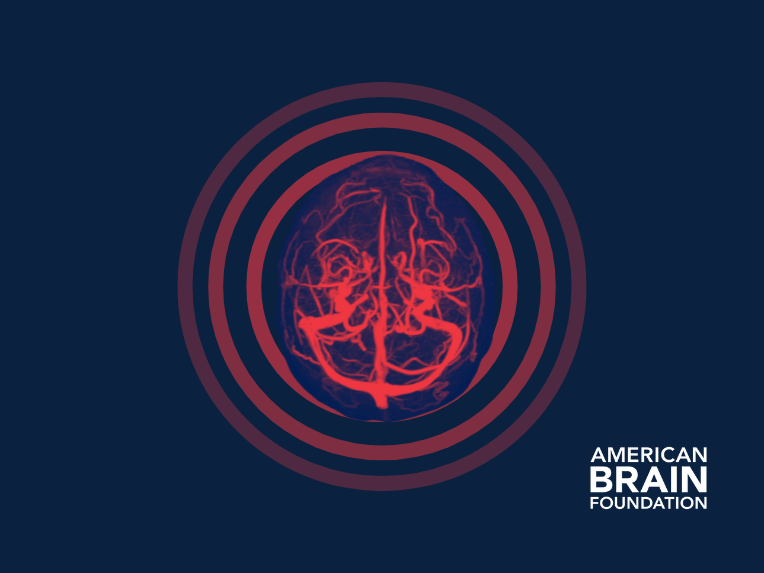 Angelman Syndrome | American Brain Foundation