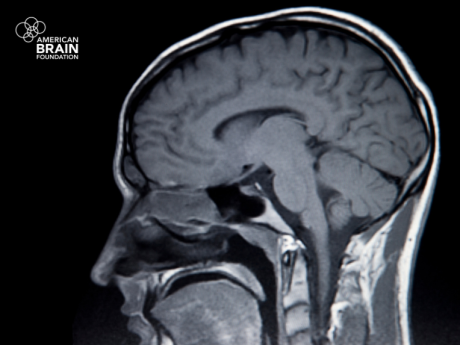 How Does Stroke Connect to Other Diseases and Surgery? - American Brain ...