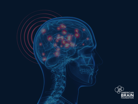 Updates on Deep Brain Stimulation as a Therapy - American Brain Foundation