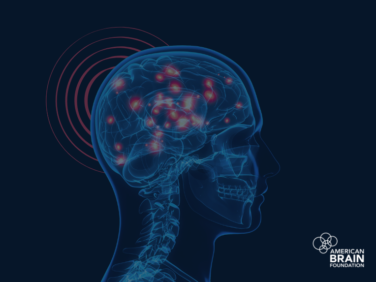 Updates on Deep Brain Stimulation as a Therapy - American Brain Foundation