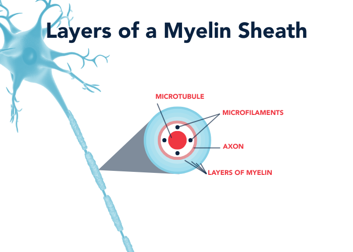 The Process of Demyelination - American Brain Foundation
