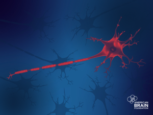 Adrenoleukodystrophy (ALD) - American Brain Foundation