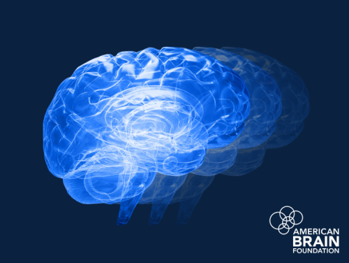 Brain Aging Explained: What Speeds It Up, and What We Can Do to Prolong Brain Health - American ...